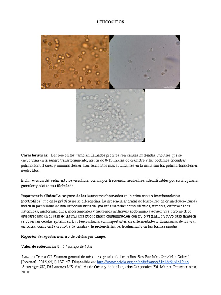 LEUCOCITOS (Muestra de Orina) | PDF