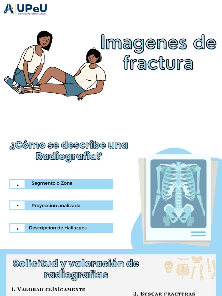 Imagenes de Fractura | PDF | Mano | Rodilla