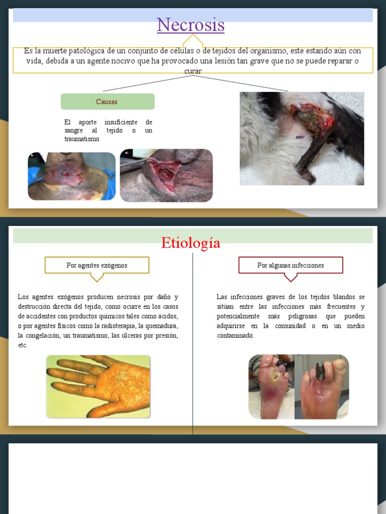 Tipos y Causas de Necrosis | PDF | Inflamación | Biología Celular)