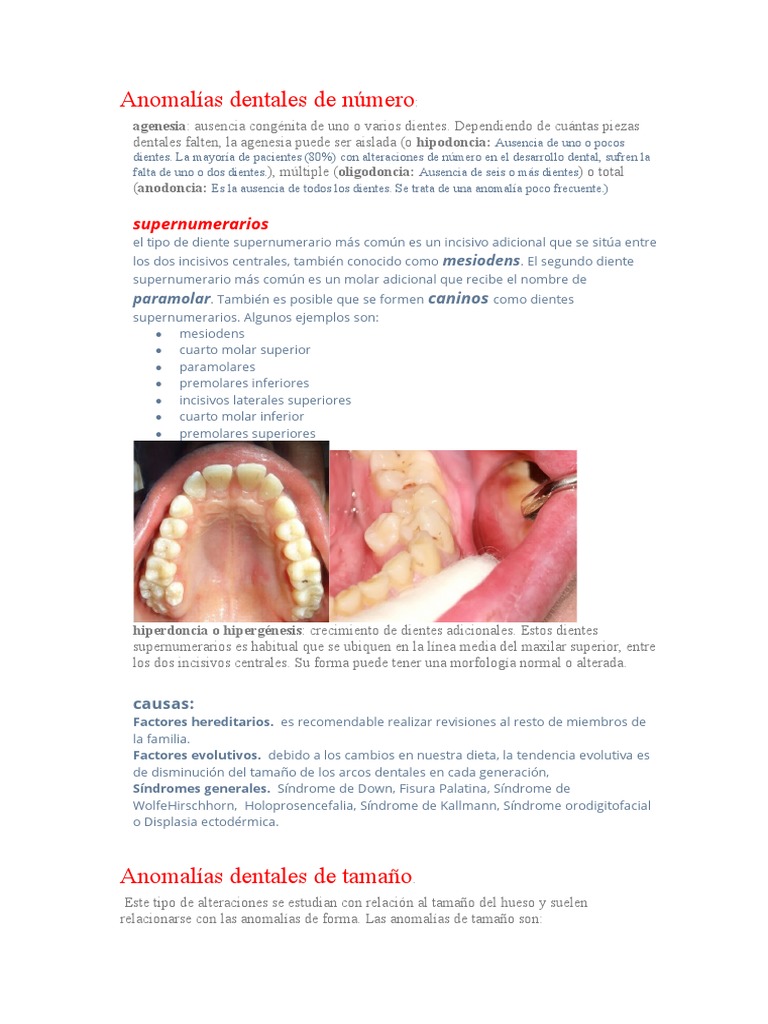 Anomalias de tamaño forma y numero_-535819786 | PDF | Anatomia dental ...