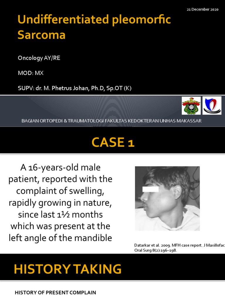 ONCO 21 Desember 2020 Undiferentiated Pleomorfic Sarcoma Rev 1 | PDF | Sarcoma | Magnetic ...