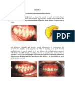 Clasificación Angle | PDF | Ortodoncia | Odontología