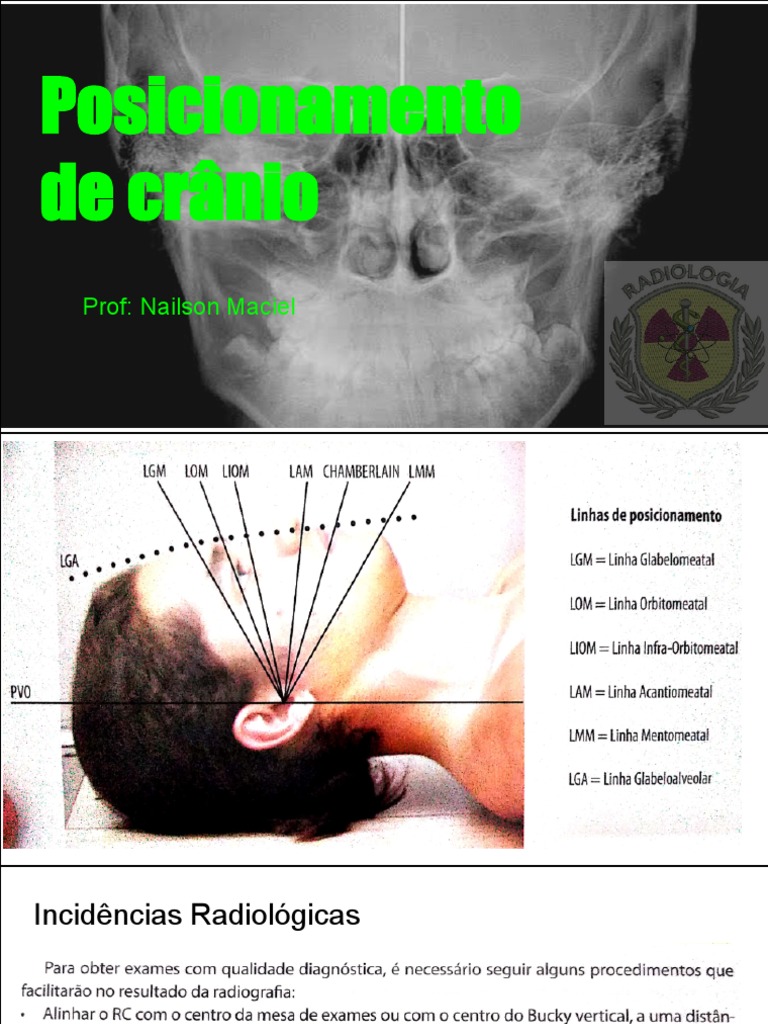 Posicionamento Radiológico do Crânio | PDF | Inclinação orbital