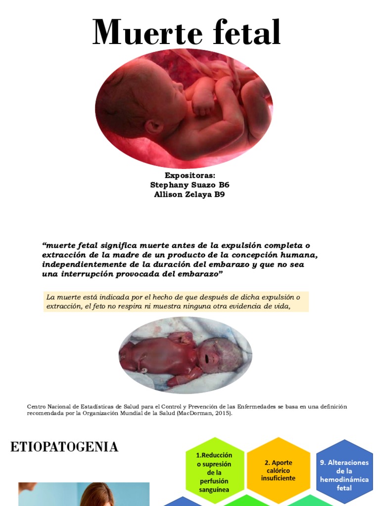 Muerte Fetal - Ginecología | PDF | Feto | El embarazo