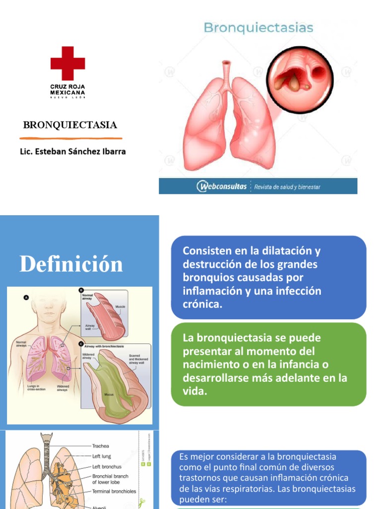 BRONQUIECTASIA | PDF | Tos | Sistema respiratorio