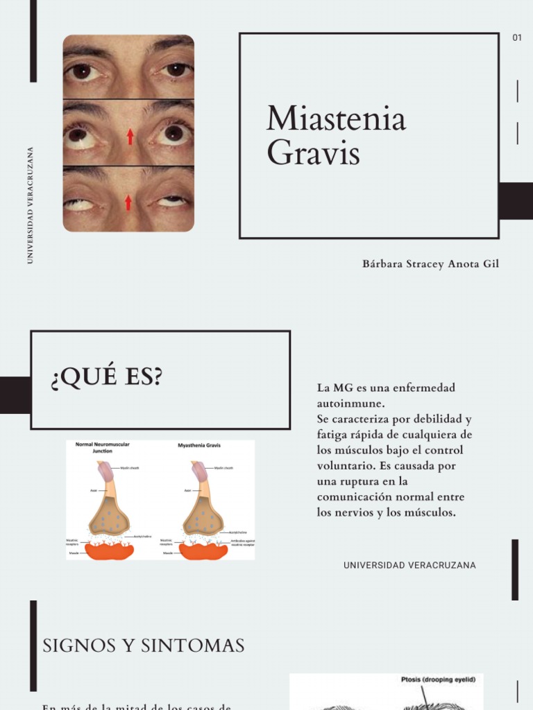 Miastenia Gravis | PDF