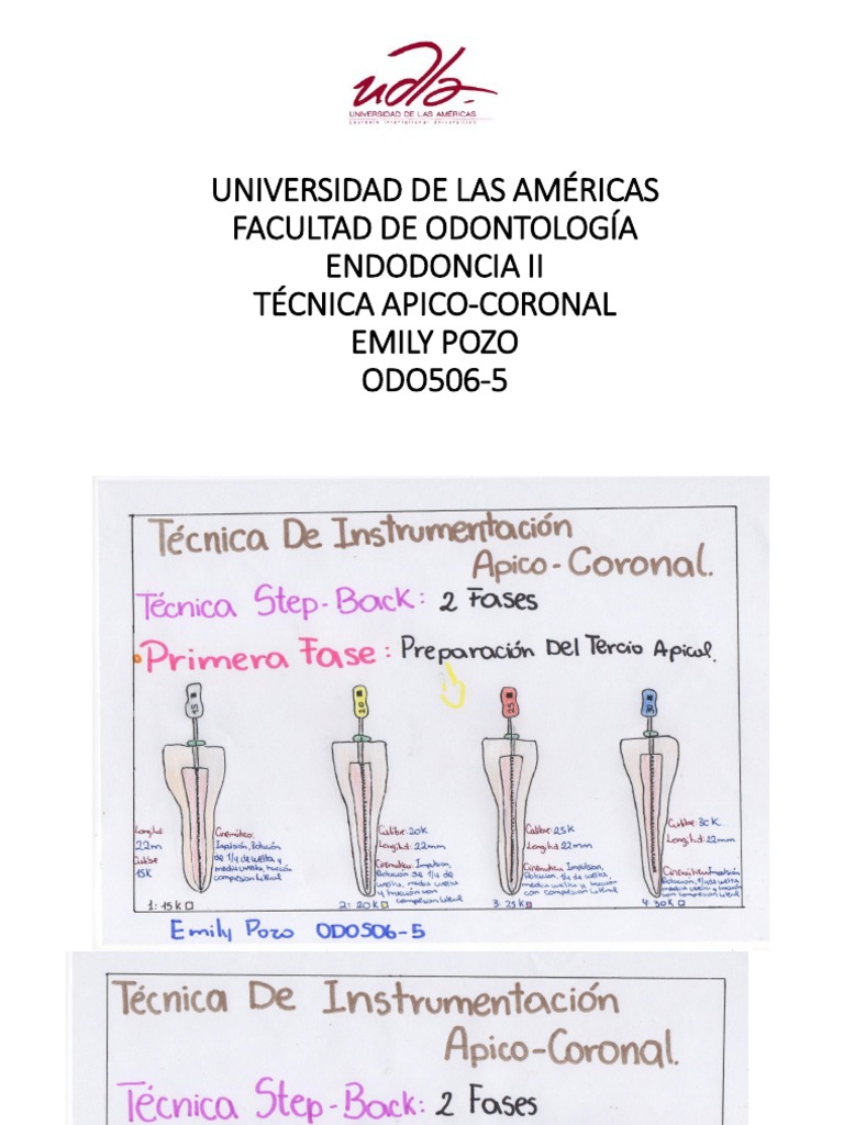 Gráfico Sobre La Tecnica Apico-Coronal | PDF