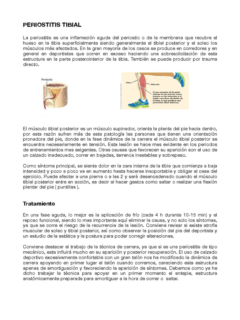 Periostitis Tibial: Causas y Tratamiento | PDF | Pie | Corriendo