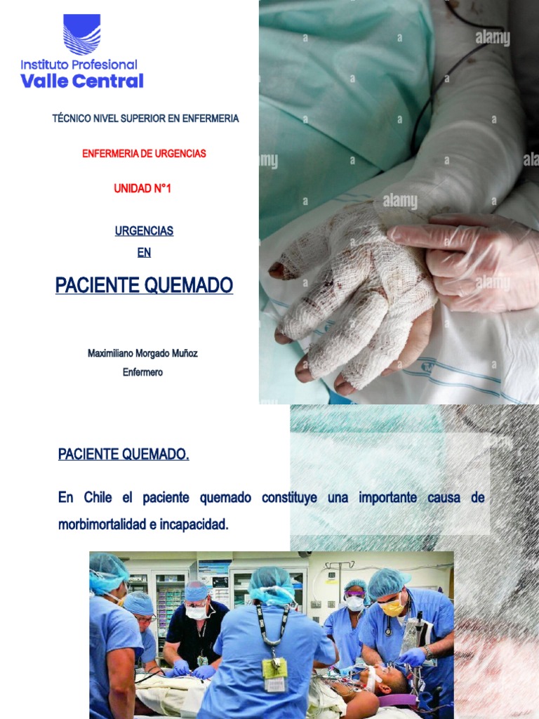 Unidad N°2 - Paciente Quemado. | PDF | Quemar | Piel