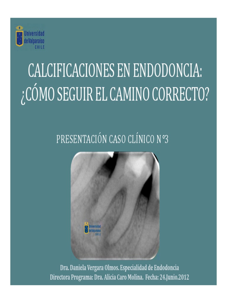 Calcificaciones en Endodoncia: ¿Cómo Seguir El Camino Correcto? | PDF ...