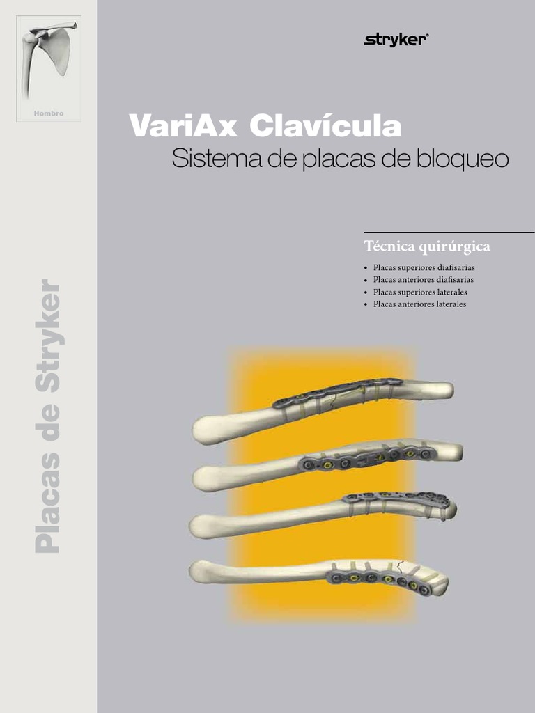 Variax Clavícula | PDF | Tornillo | Cirugía