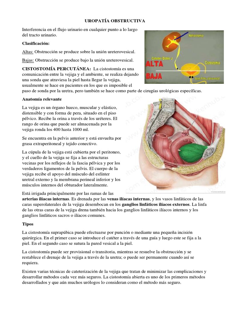 CISTOSTOMÍA | PDF | Vejiga urinaria | Sistema urinario