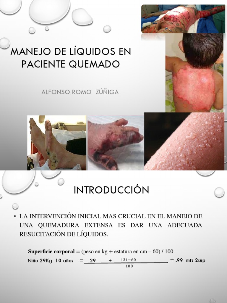 Manejo de Líquidos en Paciente Quemado Copia 2 PDF | PDF | Quemar ...