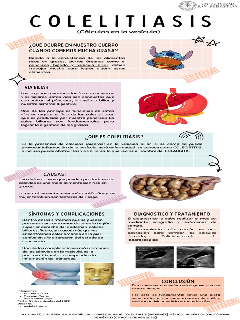 Colelitiasis | PDF | Vesícula biliar | Enfermedades y trastornos