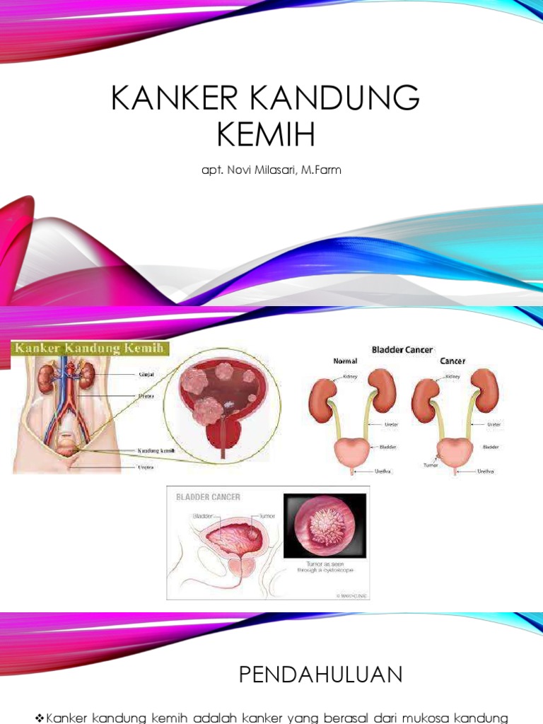 Kanker+kandung+kemih | PDF | Sains & Matematika
