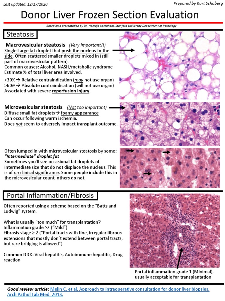 Frozen Section Evaluation of Donor Liver and Kidney Tissue: Identifying ...