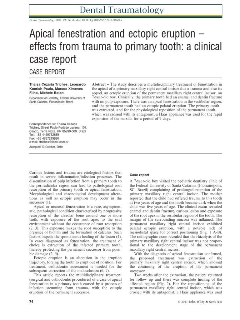 Apical Fenestration and Ectopic Eruption - Effects From Trauma To ...