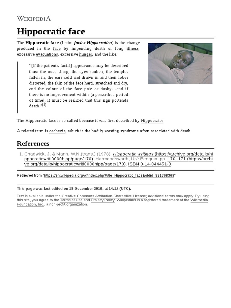 Hippocratic Face PDF | PDF