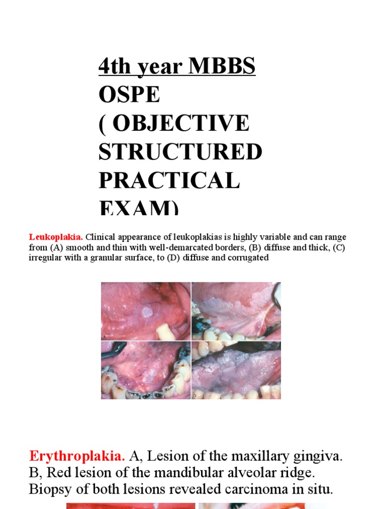 4th Year MBBS OSPE: GI Pathologies | PDF | Social Science | Wellness