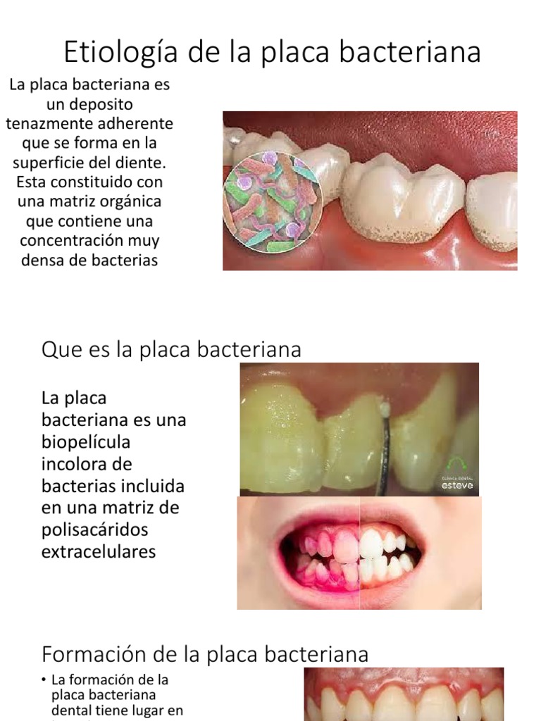 Placa bacteriana.pdf | PDF