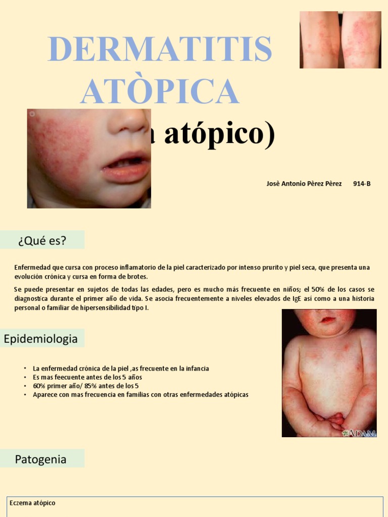 DERMATITIS ATOPICA PEDIATRIAAA.pptx | PDF | Alergia | Especialidades ...