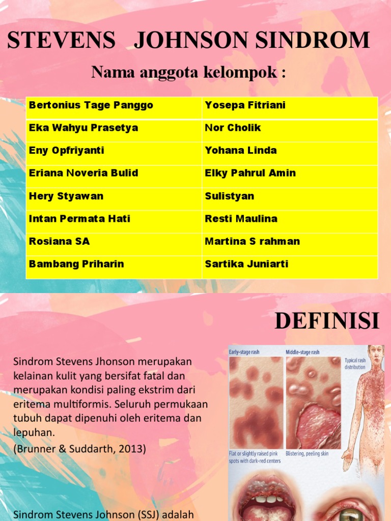 Memahami Sindrom Stevens Johnson | PDF