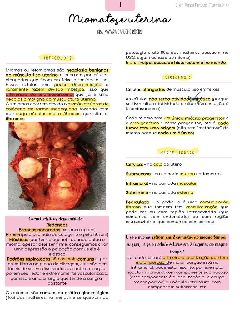 Miomatose Uterina (Dra - Mayara) | PDF | Estrogênio | Gravidez