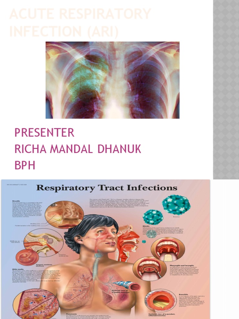 ARI Classification and Treatment Overview | PDF | Wellness | Science ...