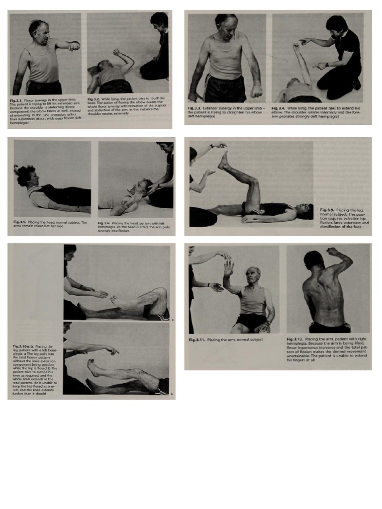 Neuro Exercise 1 PDF | PDF