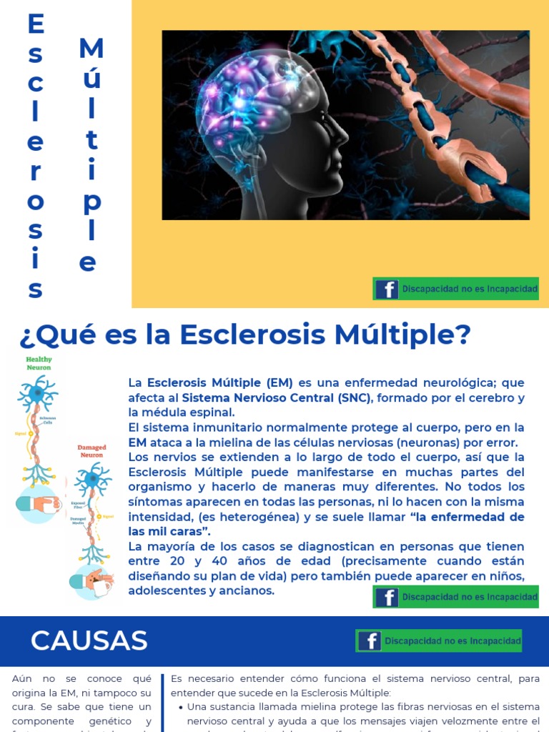 Esclerosis Múltiple | PDF | Esclerosis múltiple | Mielina