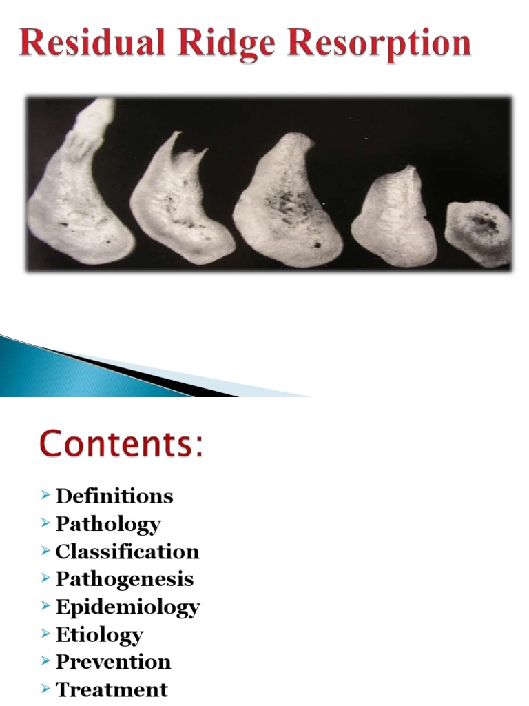 Residual Ridge Resorption | PDF | Dentures | Bone