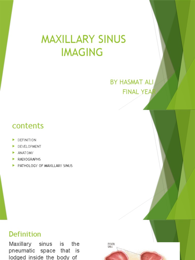 Maxillary Sinus Anatomy and Imaging | PDF | Ct Scan | Medical Imaging