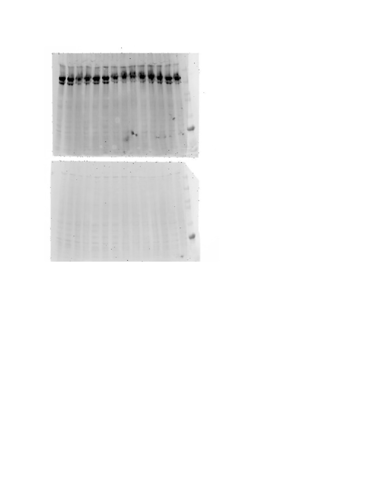Western Blot Negative Image | PDF