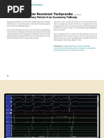 Pacemaker ID Card | PDF