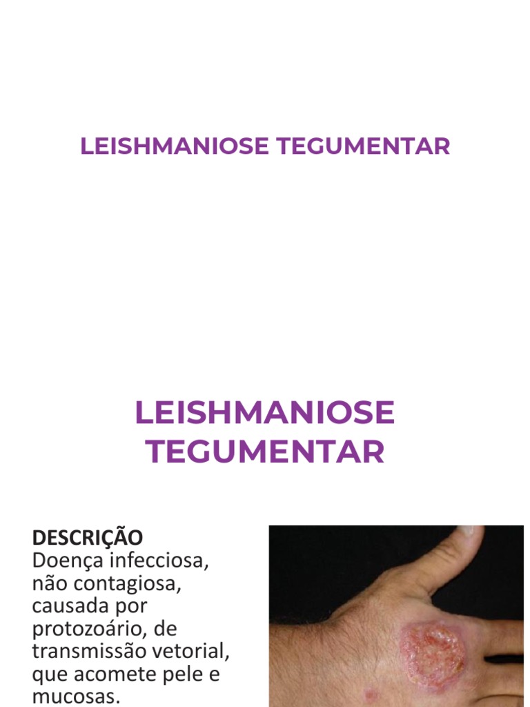 Leishmaniose Tegumentar: Doença, Transmissão e Tratamento | PDF ...