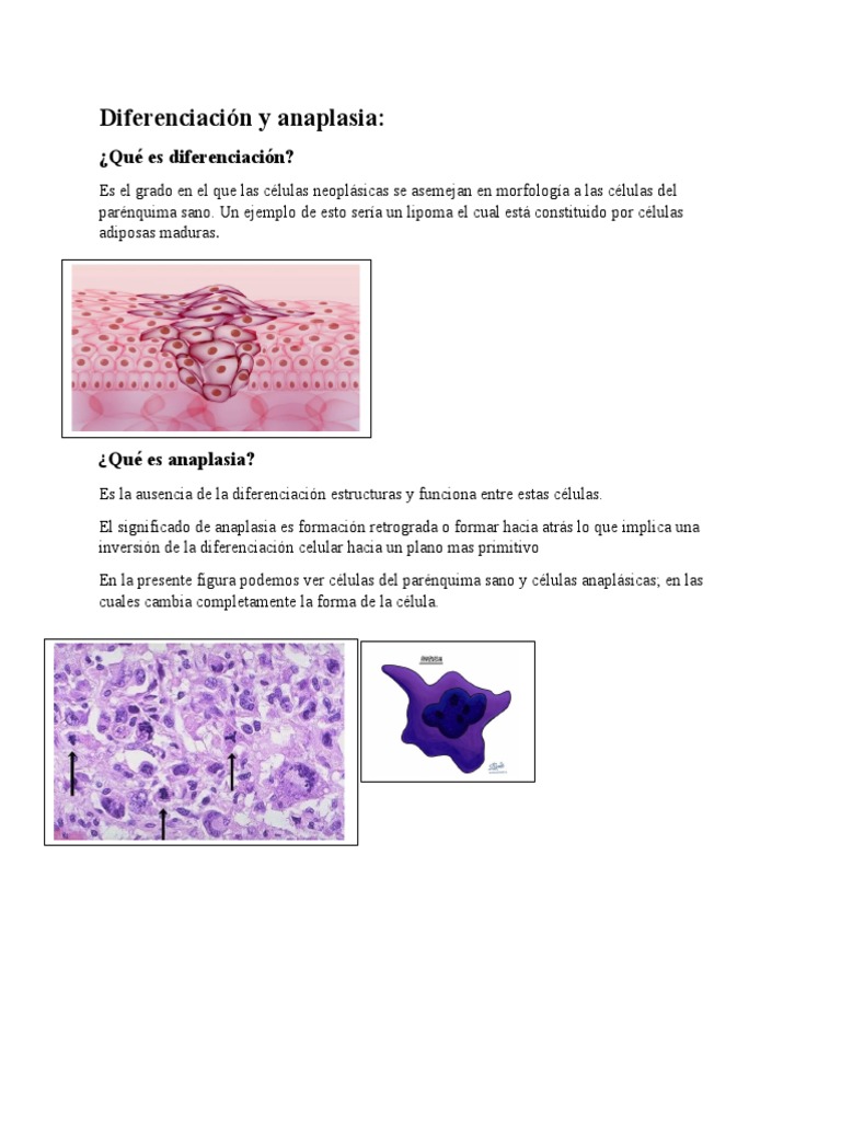 Anaplasia: Definición y Características | PDF