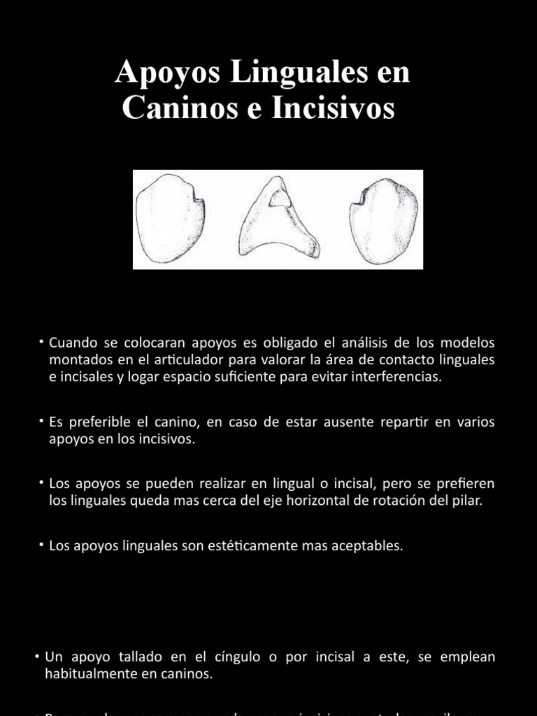 Apoyos Linguales en Caninos e Incisivos 74-80 | PDF | Dentadura postiza ...