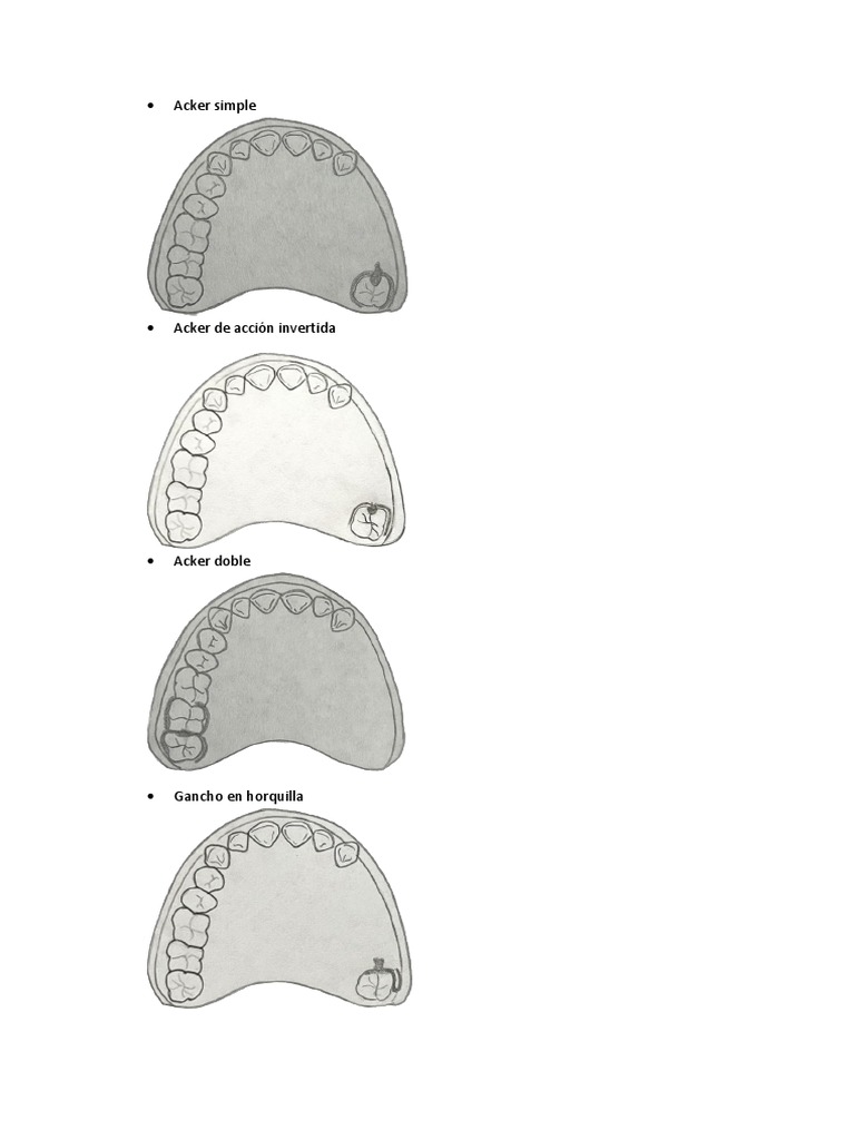GANCHOS Rehabilitacion Oral | PDF