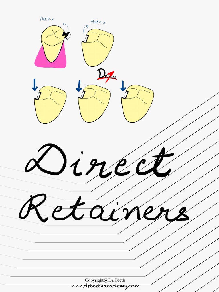Direct Retainers | Download Free PDF | Dentistry Branches