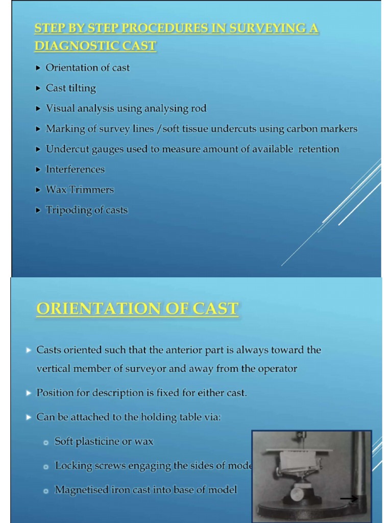 Surveying in RPD | PDF