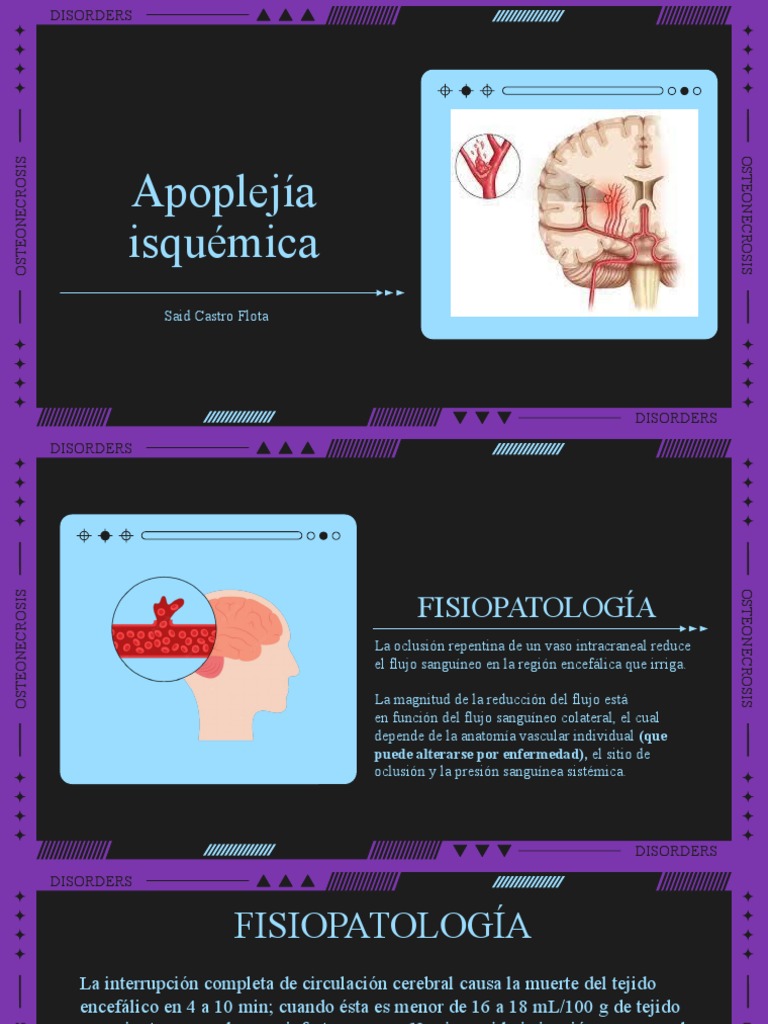Apoplejía Isquémica y Oclusión Vascular | PDF | Carrera | Plaqueta