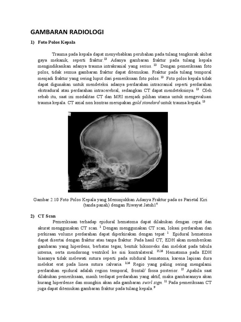 Gambaran Radiologi Edh | PDF