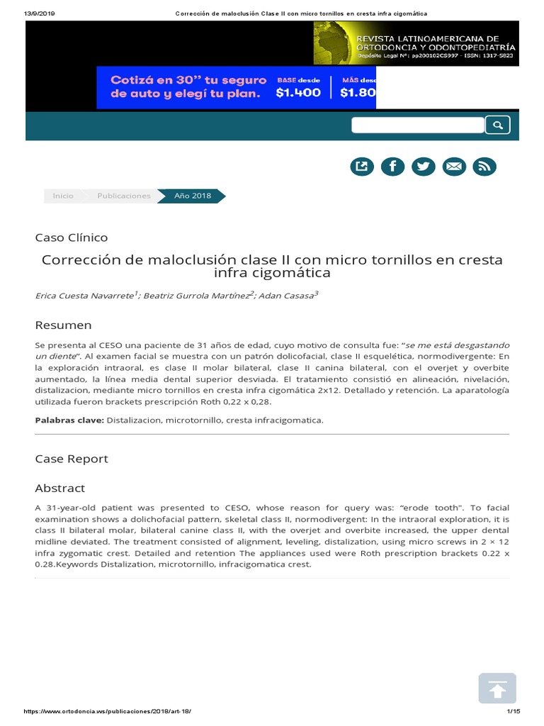 Corrección de Maloclusión Clase II Con Micro Tornillos en Cresta Infra ...