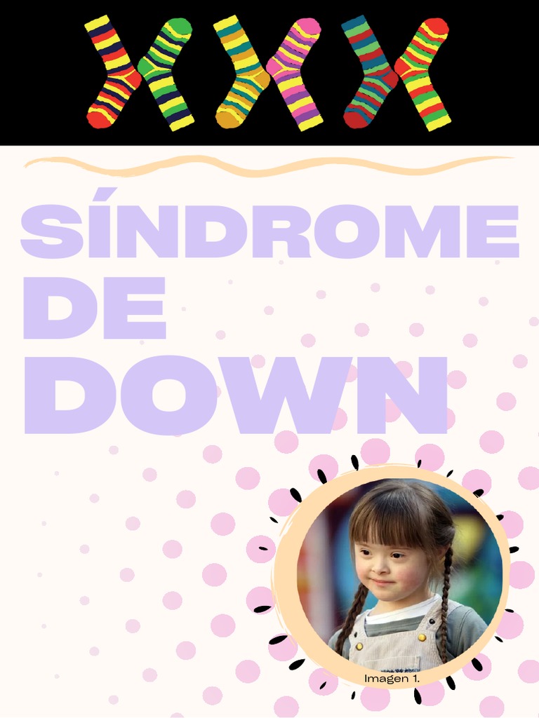 Actividades y Características del Síndrome Down | PDF | Síndrome de ...