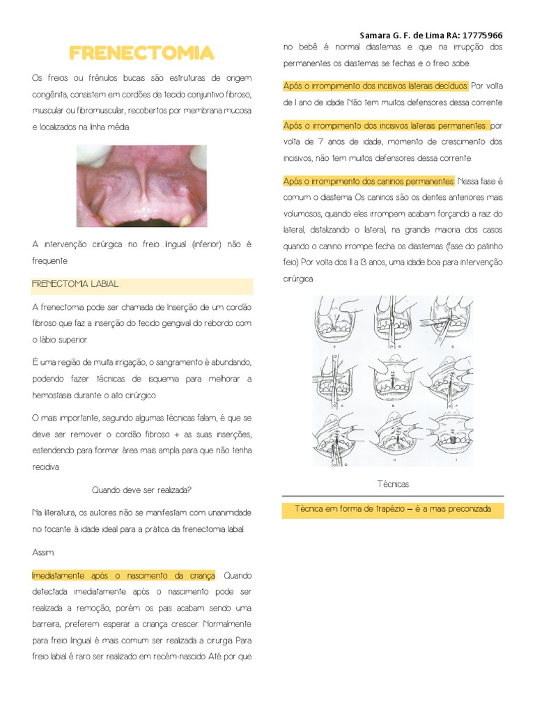 Frenectomia Labial e Lingual | PDF | Especialidades médicas | Medicina Clínica