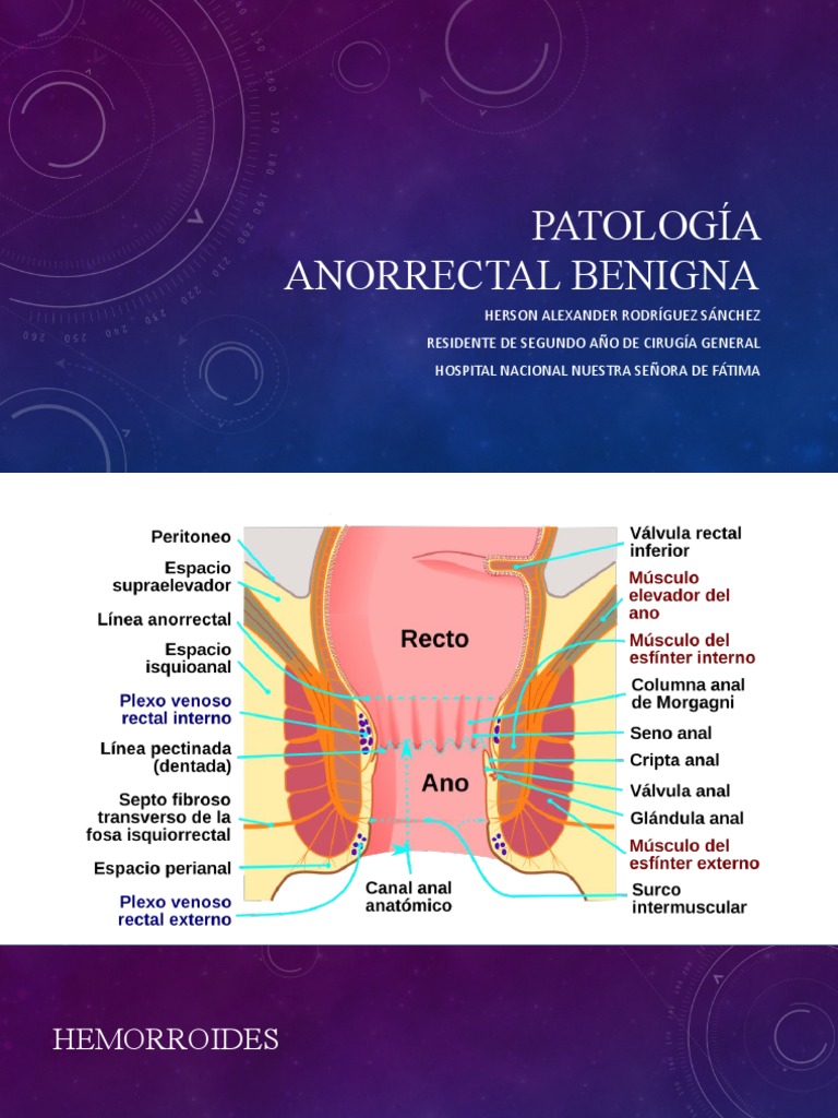 Patología Anorrectal Benigna: Hemorroides y Más | PDF