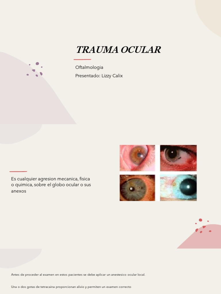 Trauma Ocular. | Descargar gratis PDF | Ojo humano | Herida