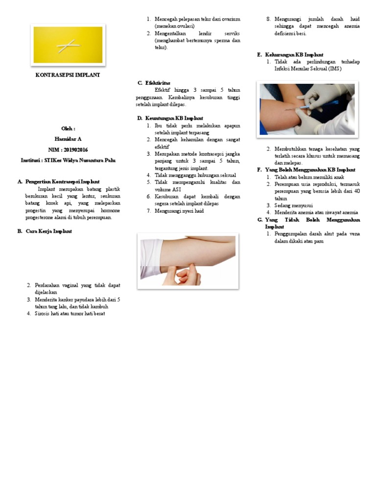 Lifleat KB Implant | PDF