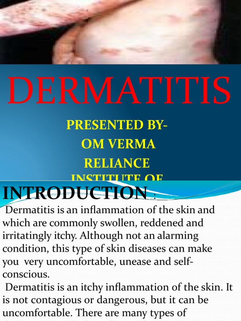 Dermatitisslide 200715172028 Pdf Dermatitis Allergy