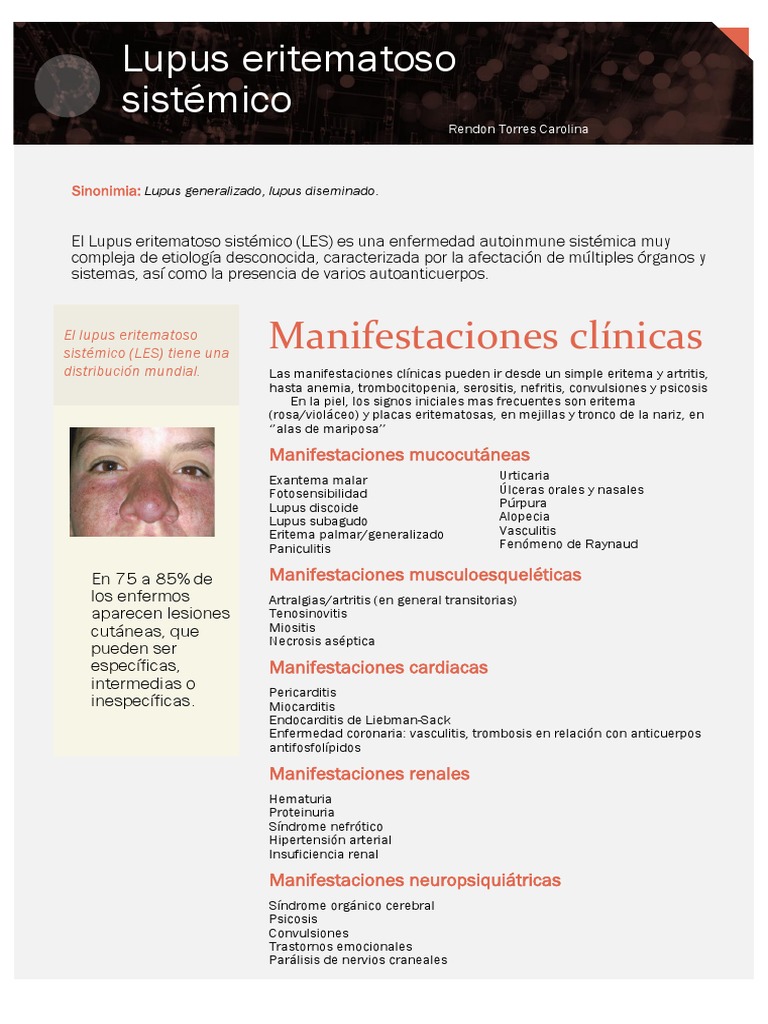 Lupus Eritematoso Sistemico | PDF | Enfermedades y trastornos | Medicina CLINICA